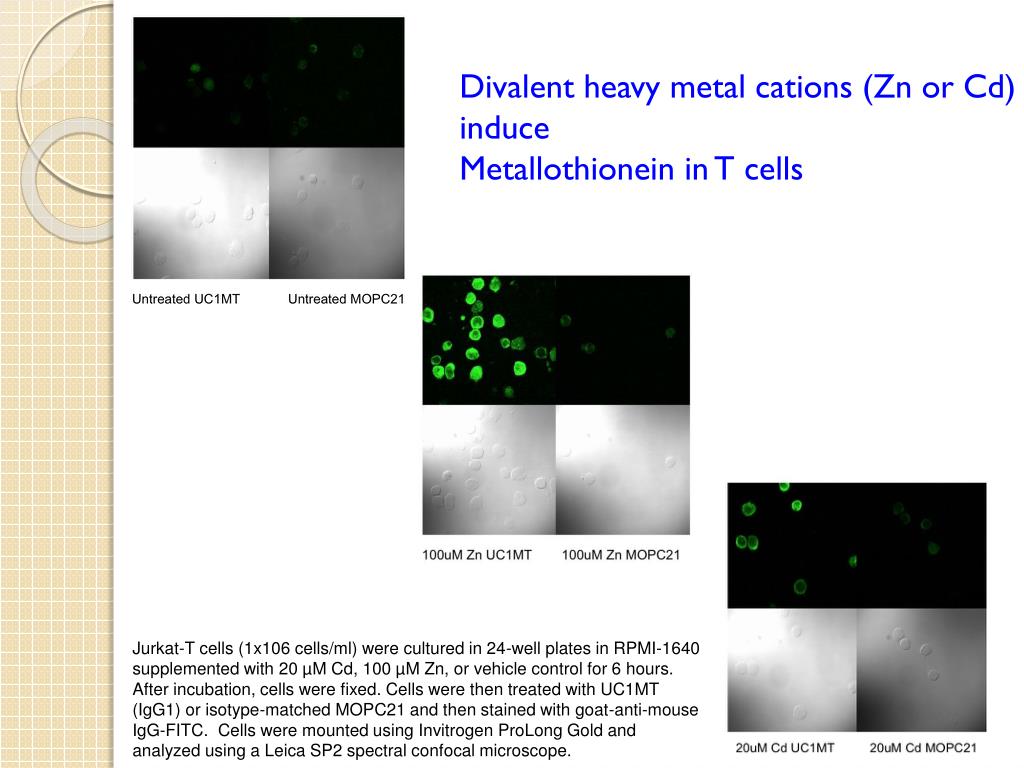 PPT - Anti-Metallothionein Therapeutics opportunities for the treatment ...