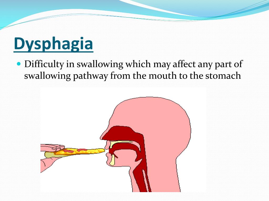 PPT - MANAGEMENT OF DYSPHAGIA PowerPoint Presentation, free download ...