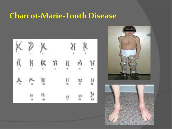 PPT - H uman chromosome and chromosome behavior PowerPoint Presentation ...