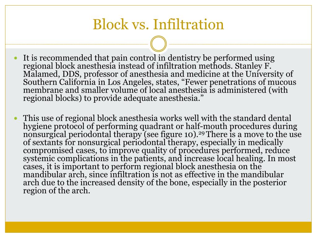 Dental Block Vs Infiltration at Albert Avila blog