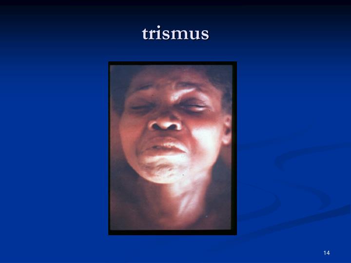 PPT - Tetanus PowerPoint Presentation - ID:2171027