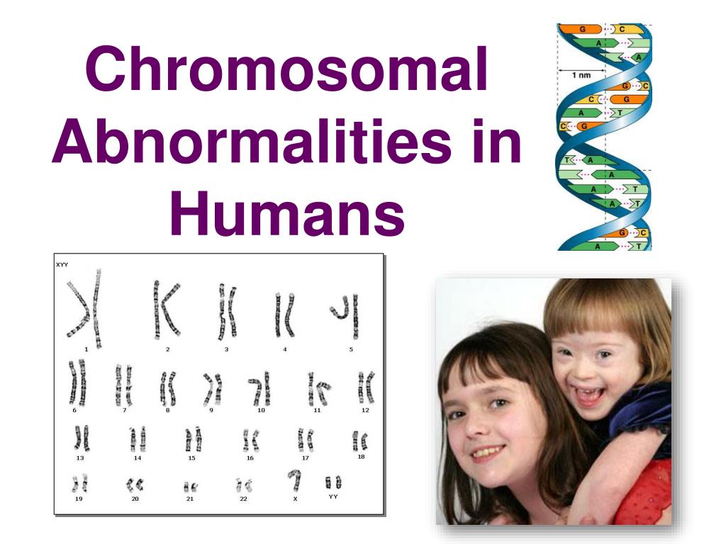 Ppt Chromosomal Abnormalities In Humans Powerpoint Presentation Free