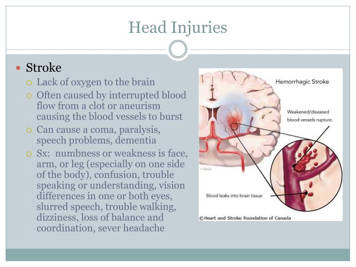PPT - Head Injuries PowerPoint Presentation - ID:2172109