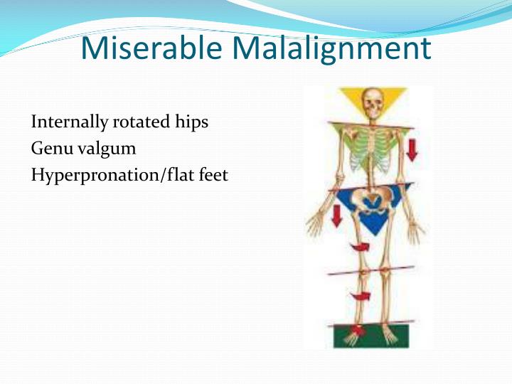 PPT - Patellofemoral Osteoarthritis PowerPoint Presentation - ID:2172402