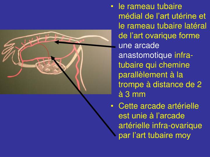 PPT - Trompe utérine PowerPoint Presentation - ID:2173008