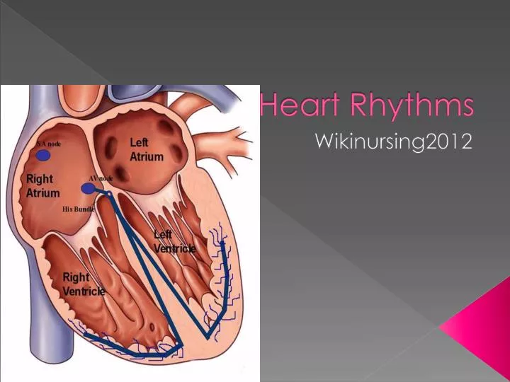 PPT - Heart Rhythms PowerPoint Presentation, free download - ID:2173528