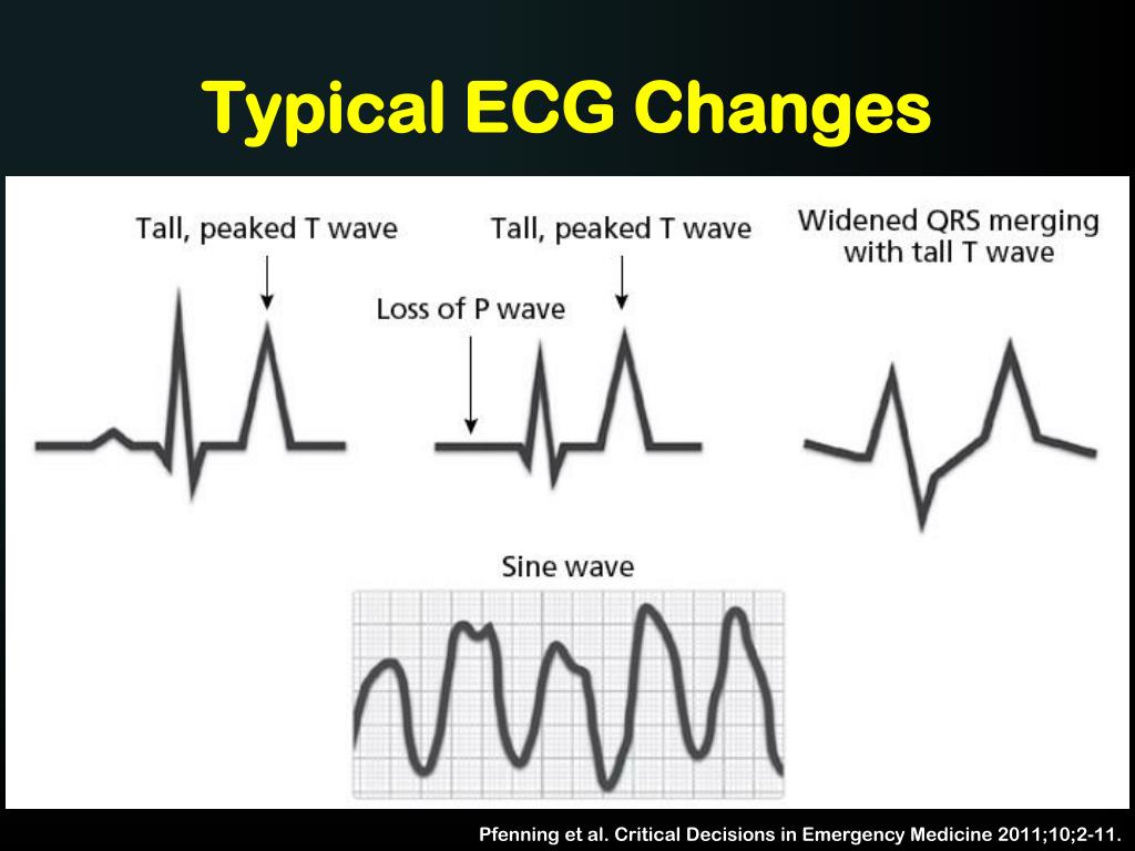 PPT - Hyponatremia and Other Critical Electrolyte Abnormalities ...