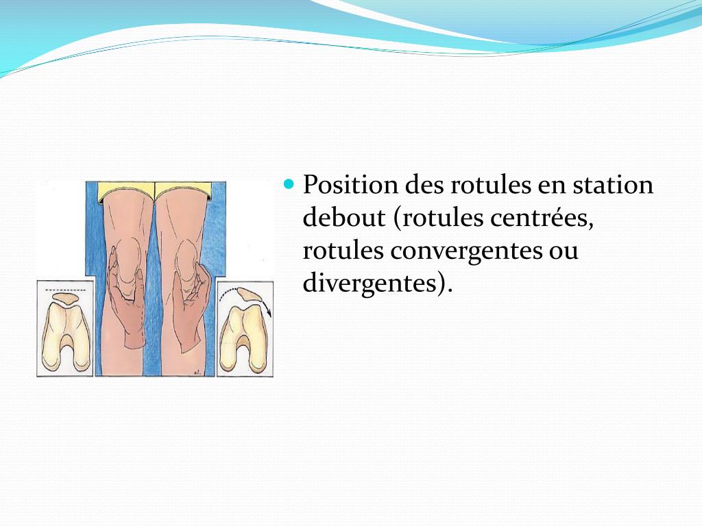 PPT - EXAMEN CLINIQUE DU GENOU Docteur Alain MOUTET (Marseille ...