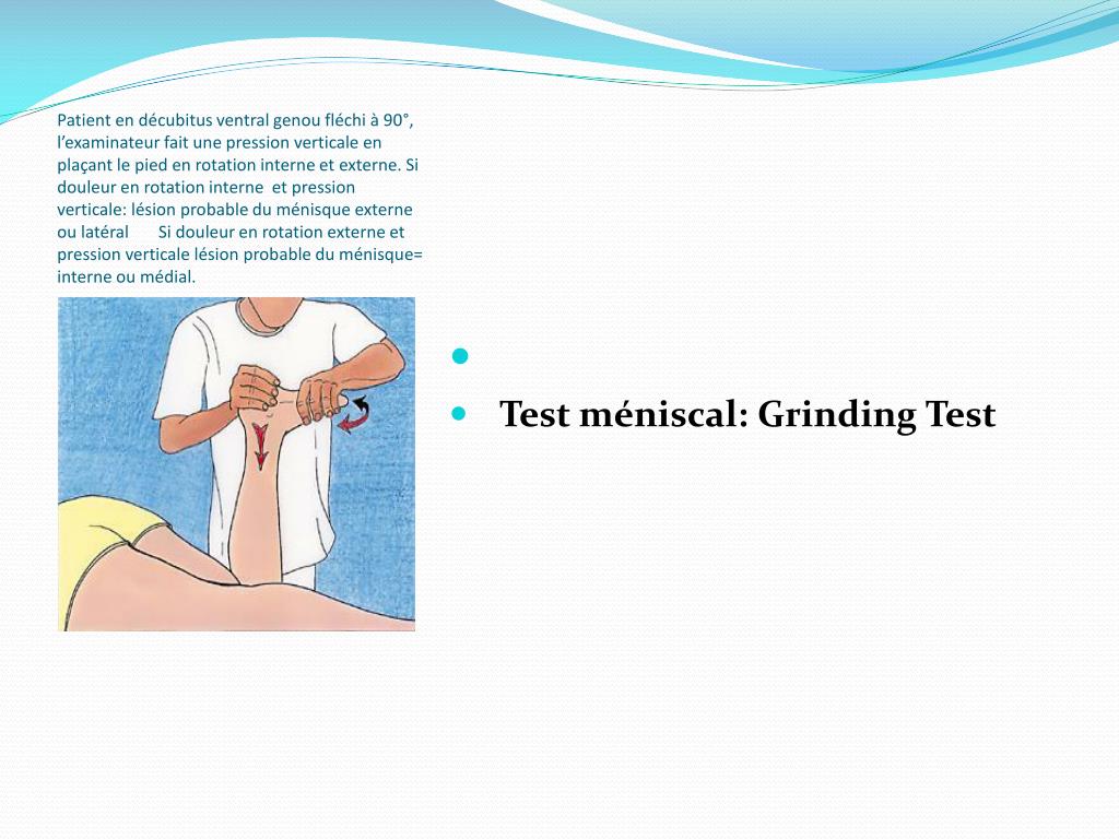 PPT - EXAMEN CLINIQUE DU GENOU Docteur Alain MOUTET (Marseille ...