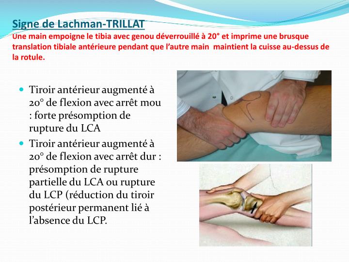 PPT - EXAMEN CLINIQUE DU GENOU Docteur Alain MOUTET (Marseille ...