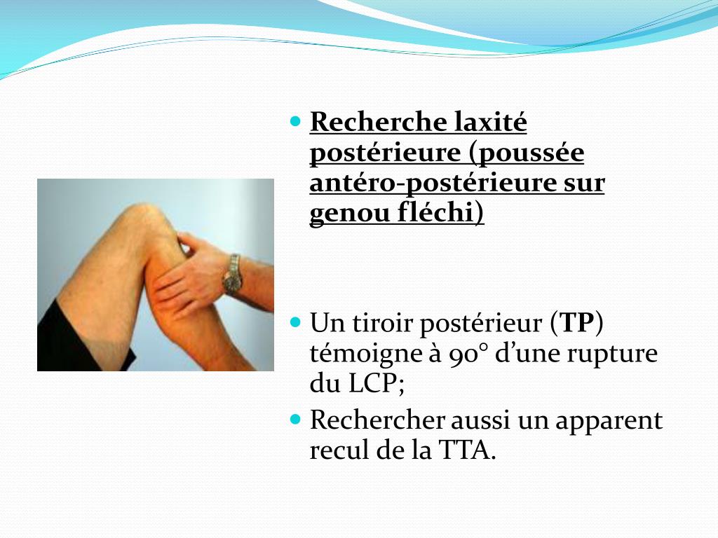 PPT - EXAMEN CLINIQUE DU GENOU Docteur Alain MOUTET (Marseille ...