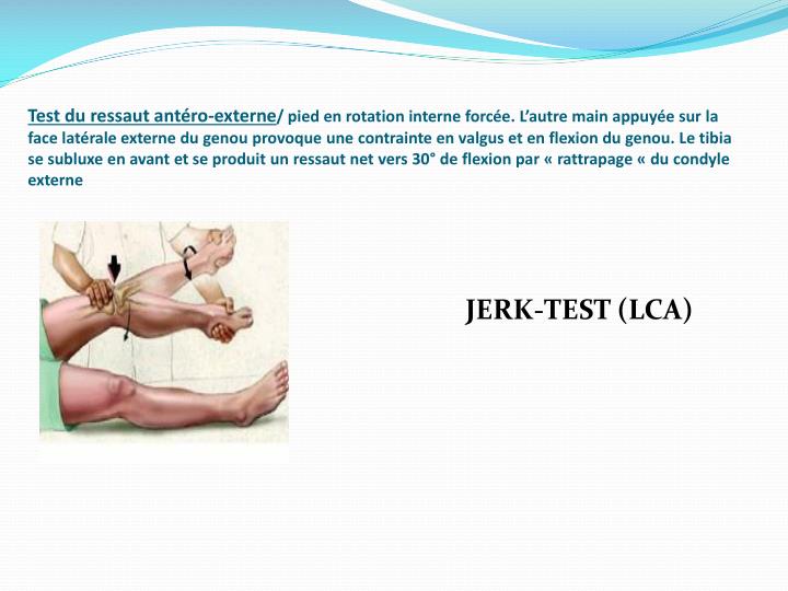 PPT - EXAMEN CLINIQUE DU GENOU Docteur Alain MOUTET (Marseille ...