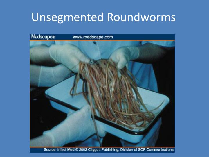 PPT - River Blindness PowerPoint Presentation - ID:2175765