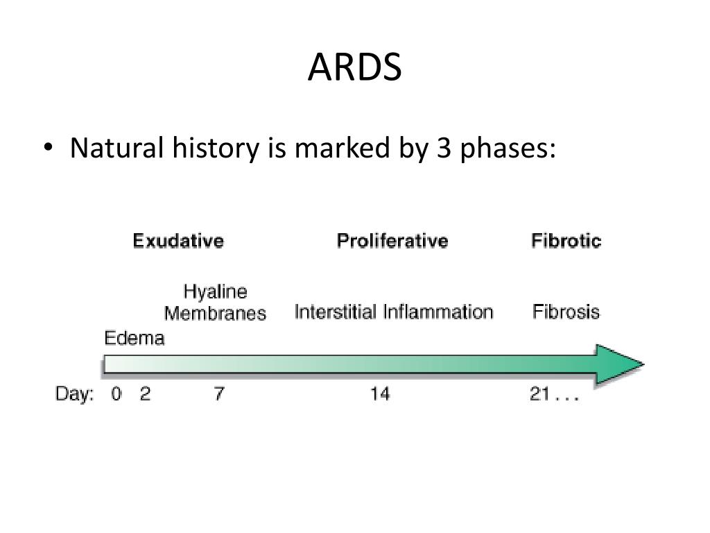 PPT - ARDS (Acute Respiratory Distress Syndrome) PowerPoint ...