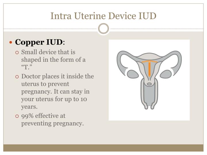 PPT - Types of Contraception PowerPoint Presentation - ID:2176475