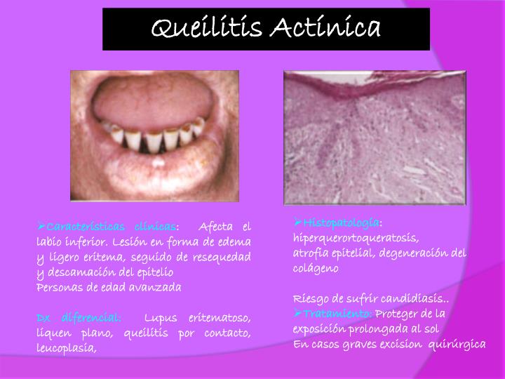 PPT - UNIVERSIDAD NACIONAL EXPERIMENTAL “RÓMULO GALLEGOS” AREA DE ...