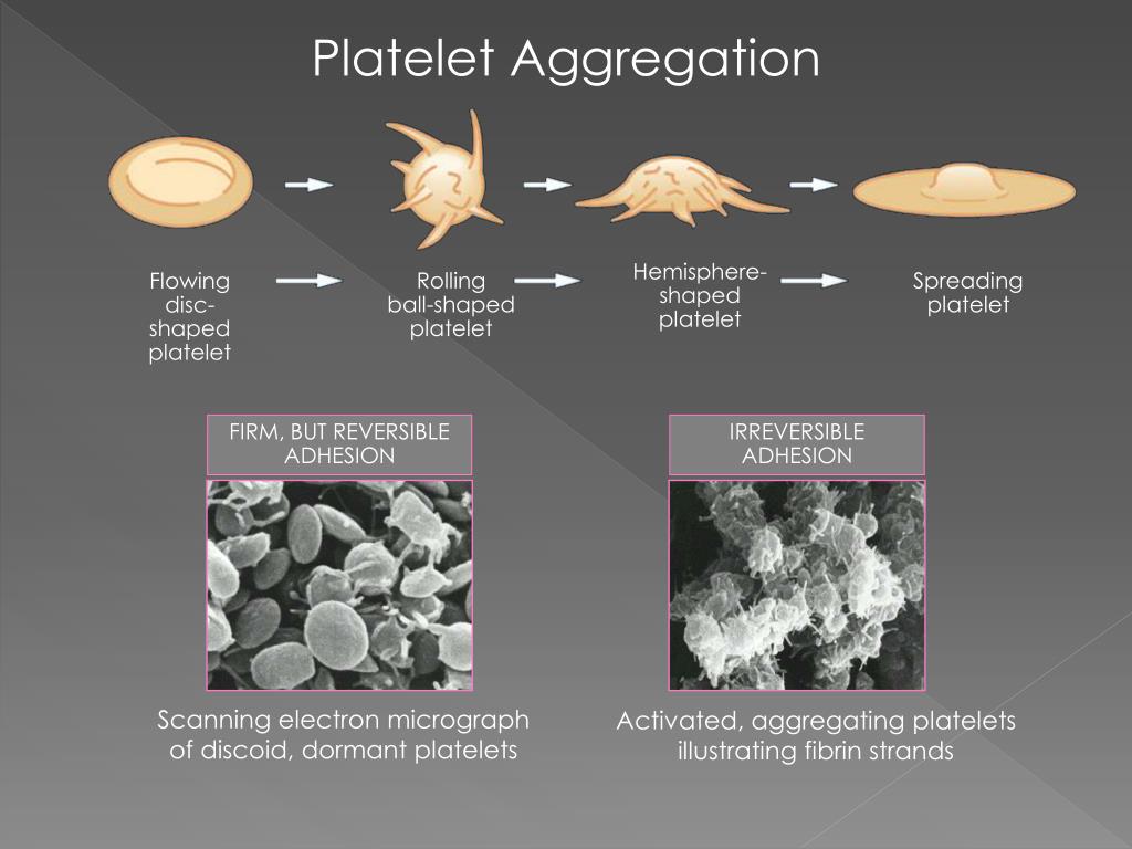 PPT - ISCHAEMIC HEART DISEASE Acute Coronary Syndromes PowerPoint ...