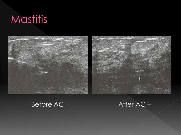 PPT - Breast Ultrasound PowerPoint Presentation - ID:2176649