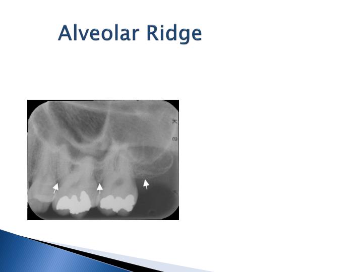 PPT - EO 005.06 Normal Intraoral Radiographic Anatomy PowerPoint ...