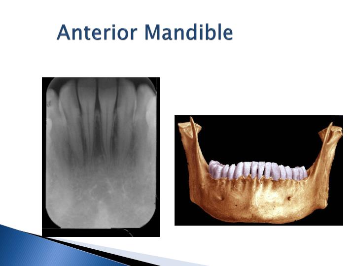 PPT - EO 005.06 Normal Intraoral Radiographic Anatomy PowerPoint ...