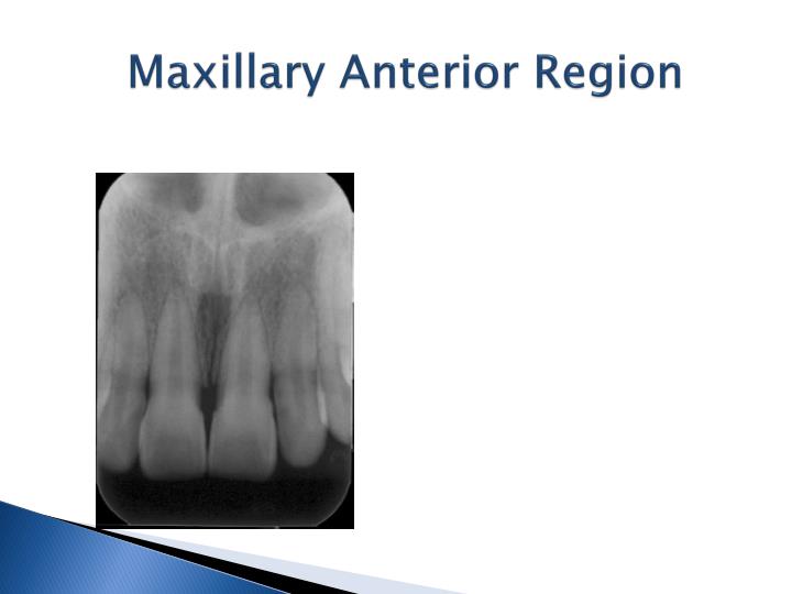 PPT - EO 005.06 Normal Intraoral Radiographic Anatomy PowerPoint ...