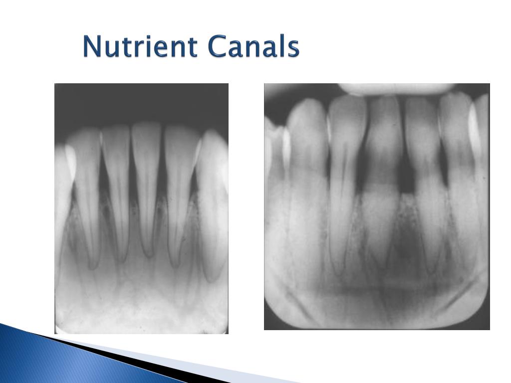 PPT - EO 005.06 Normal Intraoral Radiographic Anatomy PowerPoint ...