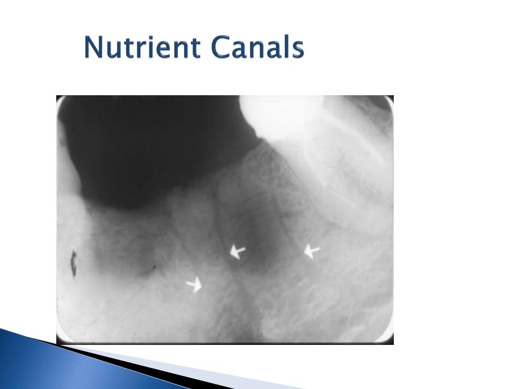 PPT - EO 005.06 Normal Intraoral Radiographic Anatomy PowerPoint Presentation - ID:2176658