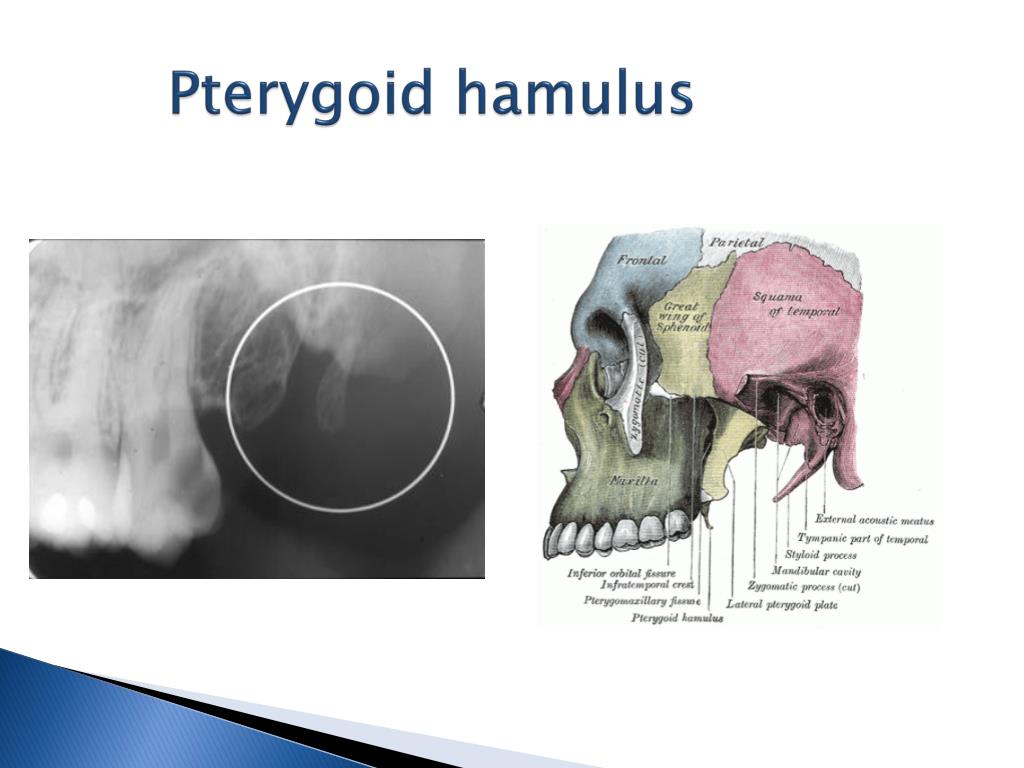 PPT - EO 005.06 Normal Intraoral Radiographic Anatomy PowerPoint ...