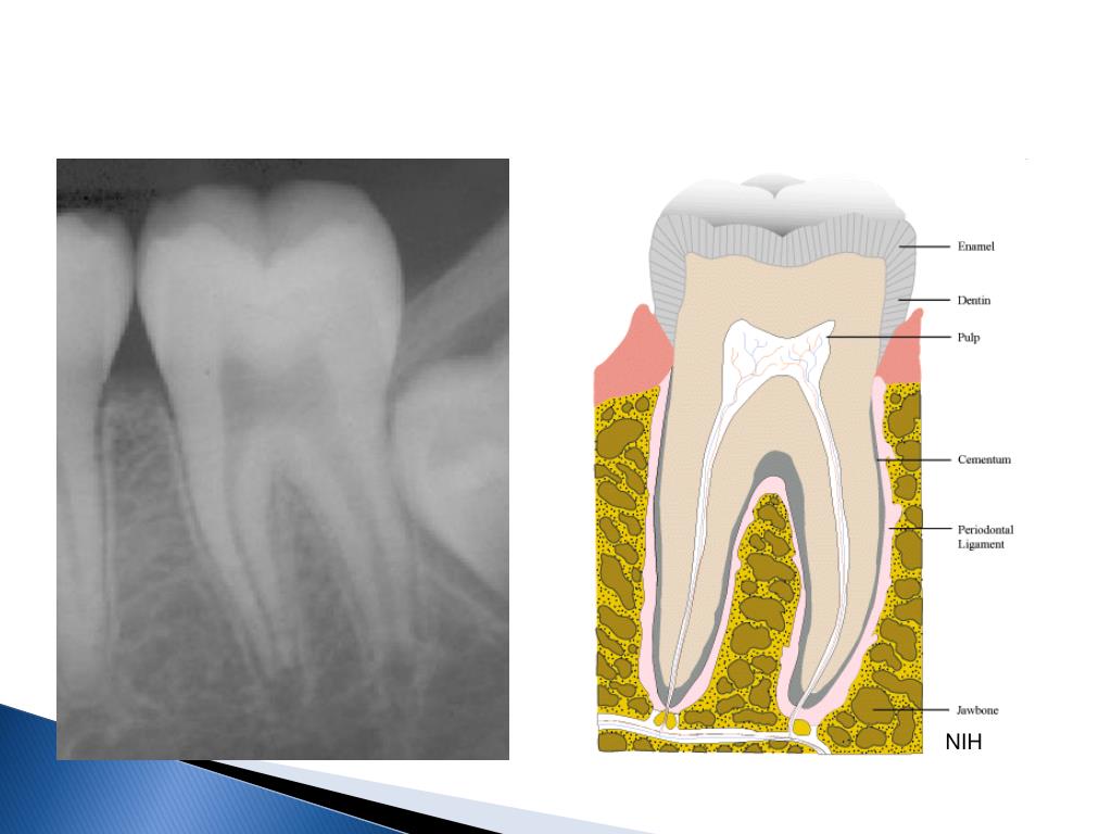 PPT - EO 005.06 Normal Intraoral Radiographic Anatomy PowerPoint ...