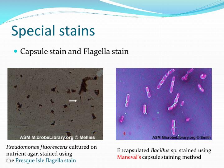 PPT - Laboratory Methods For Identification Of Bacteria PowerPoint ...