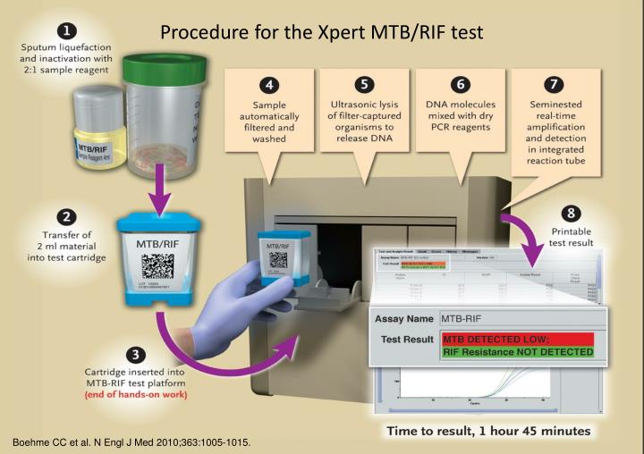 PPT - Module 11: Clinical guide to Xpert MTB/RIF PowerPoint ...