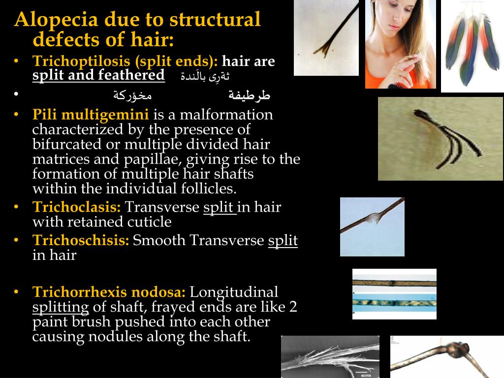 PPT - Hair and Hair Disorders By: Dr. Faraedon Kaftan College of ...