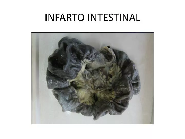 PPT - INFARTO INTESTINAL PowerPoint Presentation, free download - ID ...