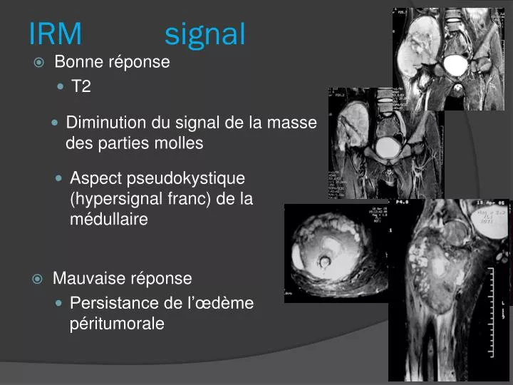 PPT - IRM signal PowerPoint Presentation, free download - ID:2178222