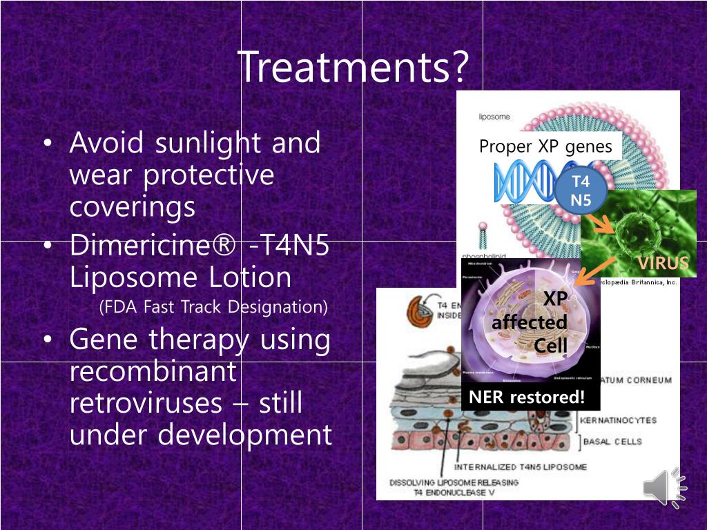PPT - DNA Repair Nucleotide Excision Repair XP and CS PowerPoint ...