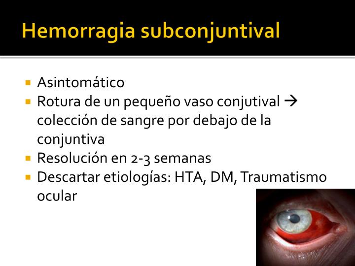 PPT - Valoración oftalmológica en AP PowerPoint Presentation - ID:2178292