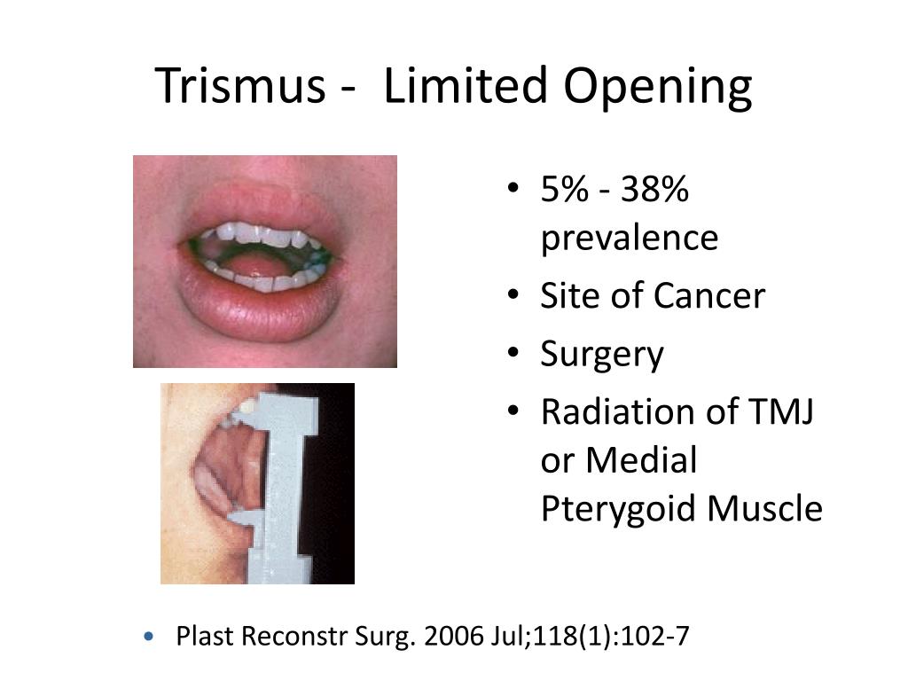 PPT - Surgical Management of Oral Pathological Lesions PowerPoint ...