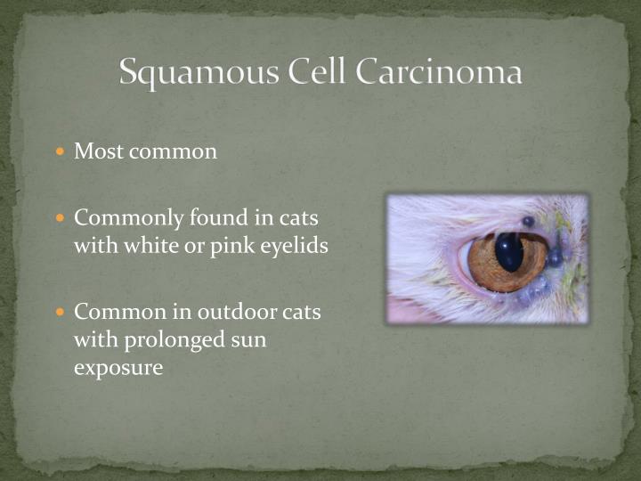PPT - Eyelid Tumors PowerPoint Presentation - ID:2178485