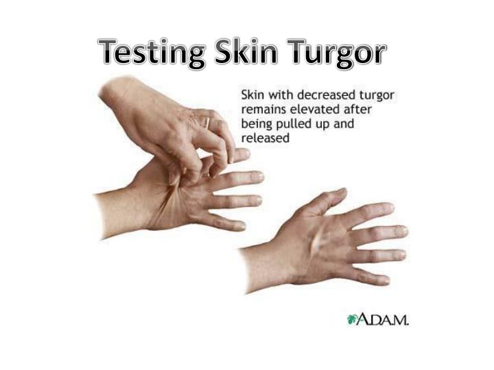 PPT - Assessment of Clients with Integumentary Disorders PowerPoint ...