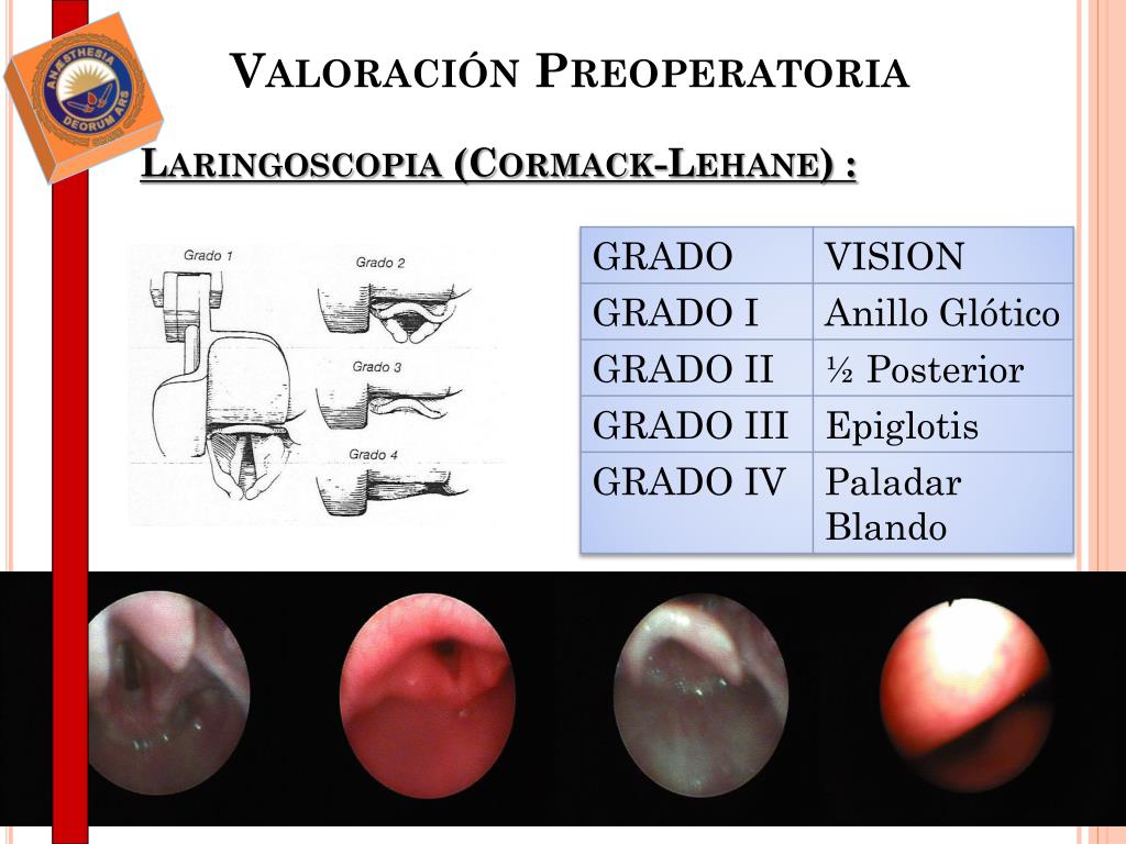 PPT - ANESTESIA PARA CIRUGIA MAYOR DE CUELLO PowerPoint Presentation ...