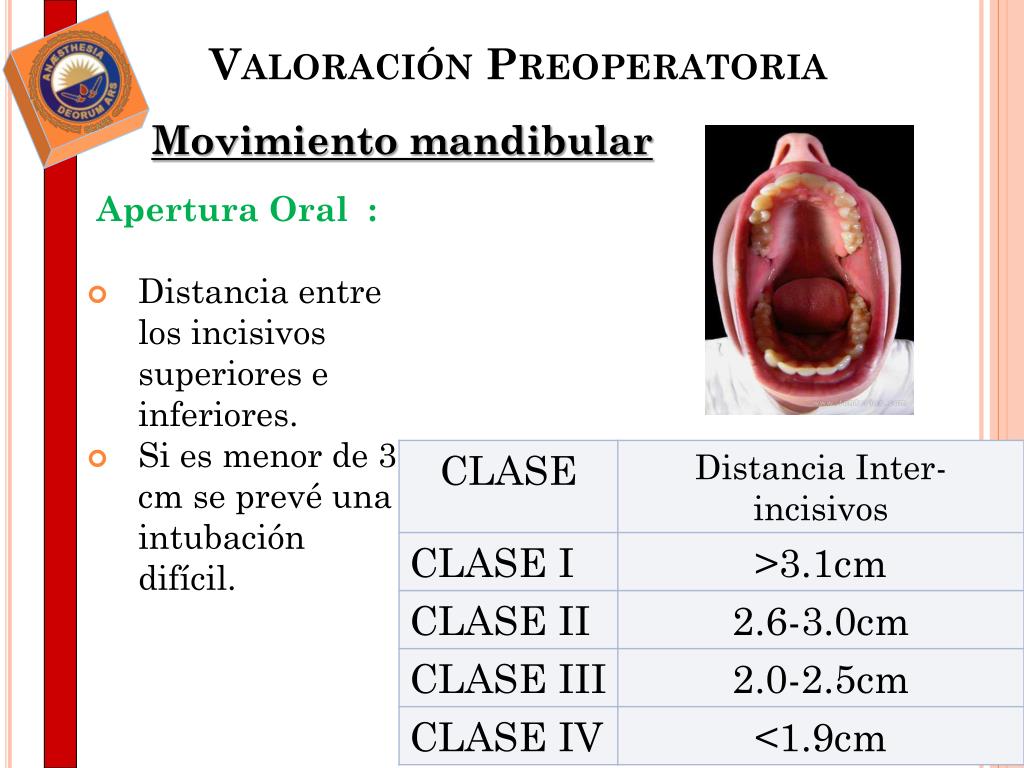 PPT - ANESTESIA PARA CIRUGIA MAYOR DE CUELLO PowerPoint Presentation ...