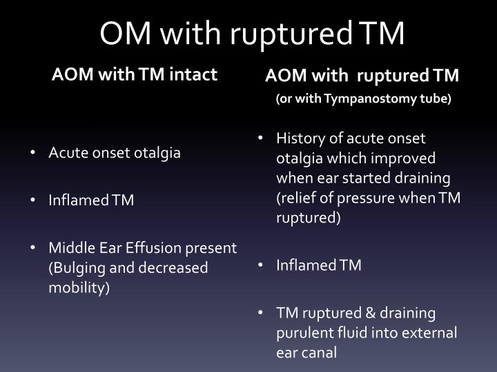PPT - Otitis Media PowerPoint Presentation - ID:2185363