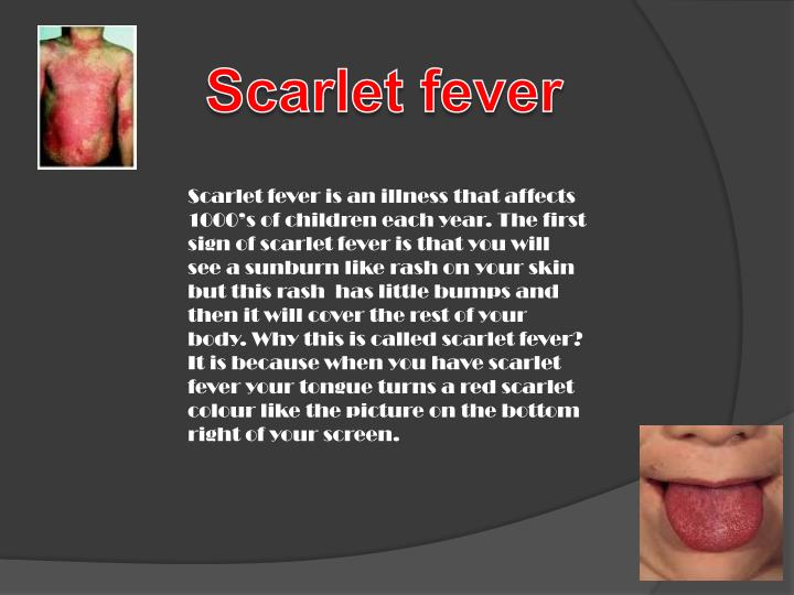 PPT - 10 most deadly diseases In the world PowerPoint Presentation - ID ...