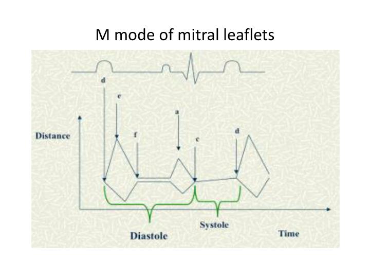 PPT - ECHOCARDIOGRAPHIC EVALUATION OF MITRAL STENOSIS PowerPoint ...