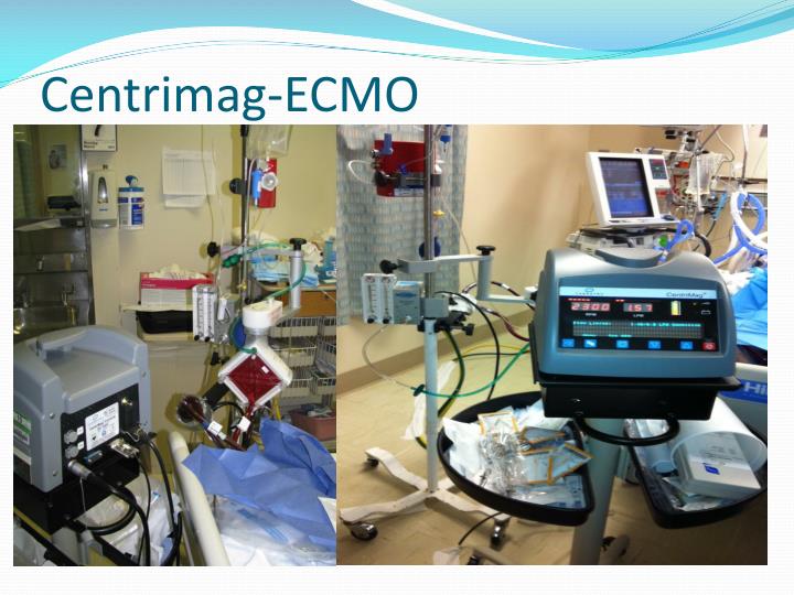 PPT - Extracorporeal Membrane Oxygenation (ECMO): Indications and ...