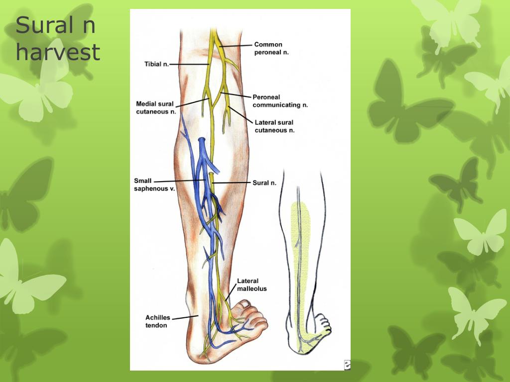 PPT - Orthopaedic + Plastic Surgical anatomy PowerPoint Presentation ...