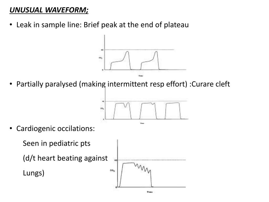 PPT - Presented by Dr Sonam Norbu Moderator Dr Aparna Sharma PowerPoint ...