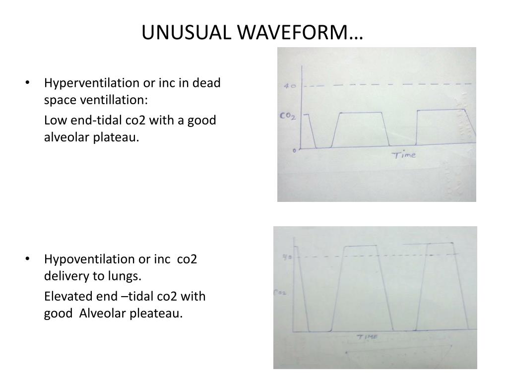 PPT - Presented by Dr Sonam Norbu Moderator Dr Aparna Sharma PowerPoint ...