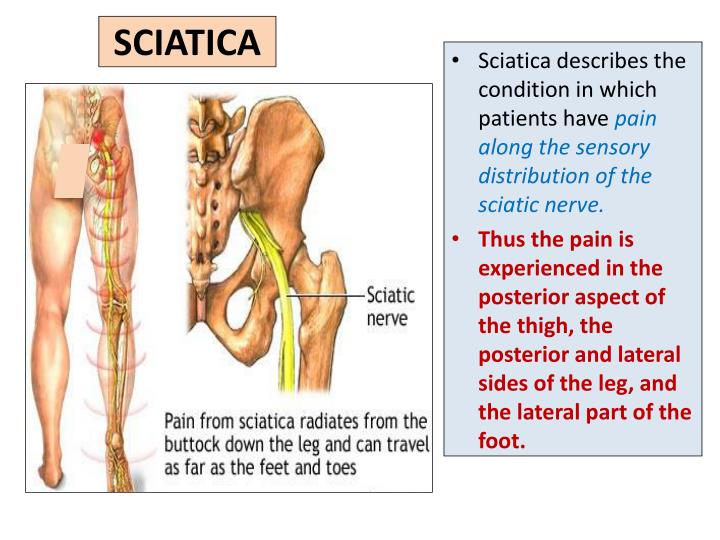 PPT - SACRAL PLEXUS FEMORAL & SCIATIC NERVES PowerPoint Presentation - ID:2189970