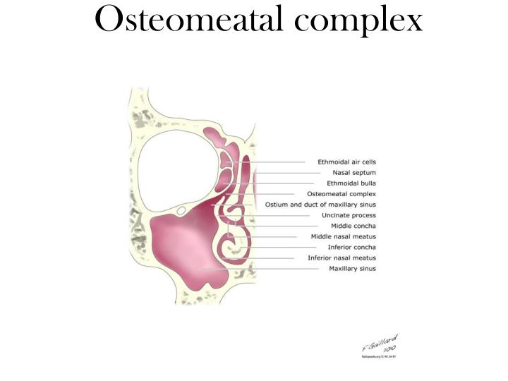 PPT - Nasal Polyposis PowerPoint Presentation - ID:2192412